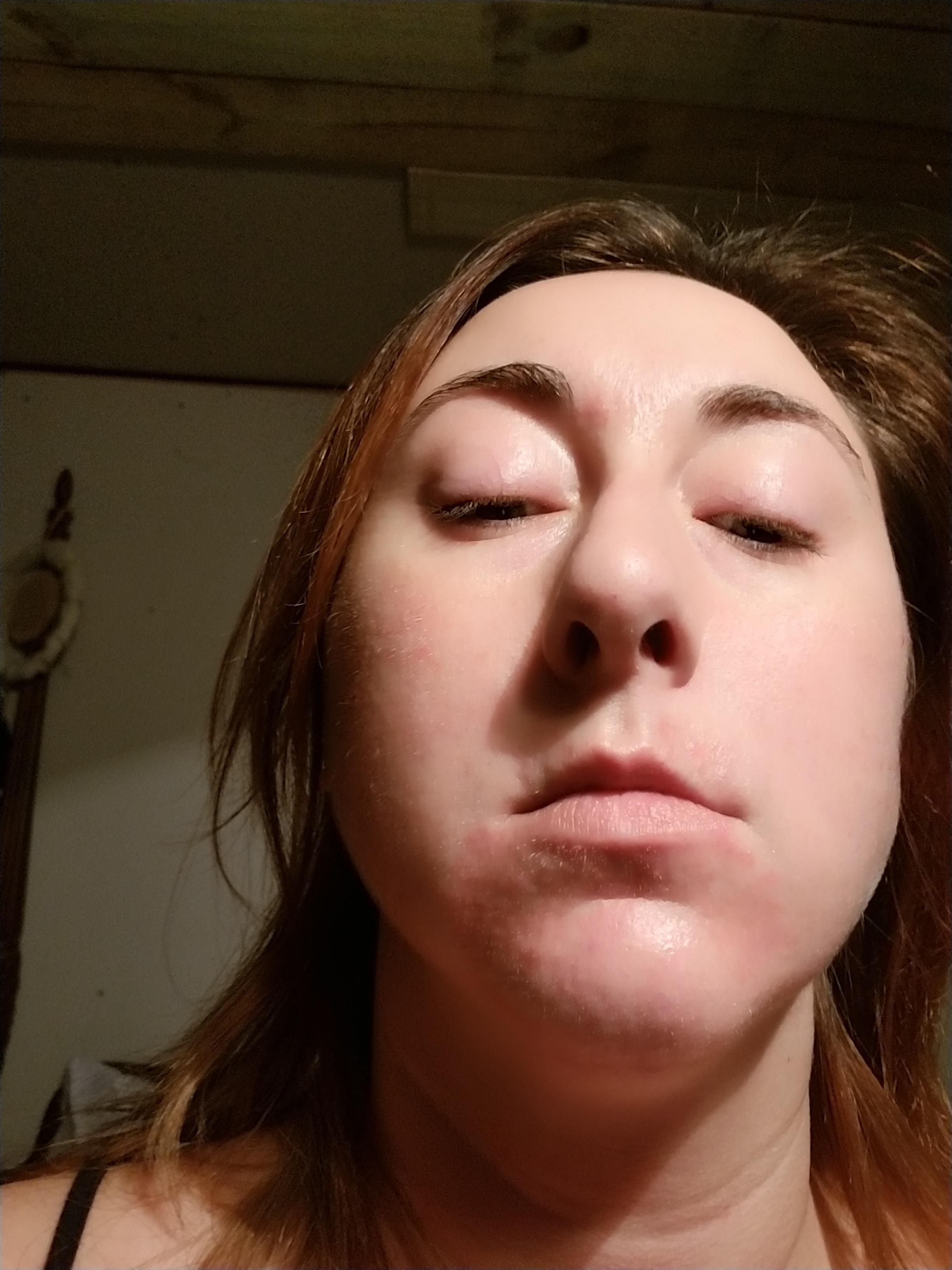 Bite Beauty - Allergic Reactions? - Beauty Insider Community