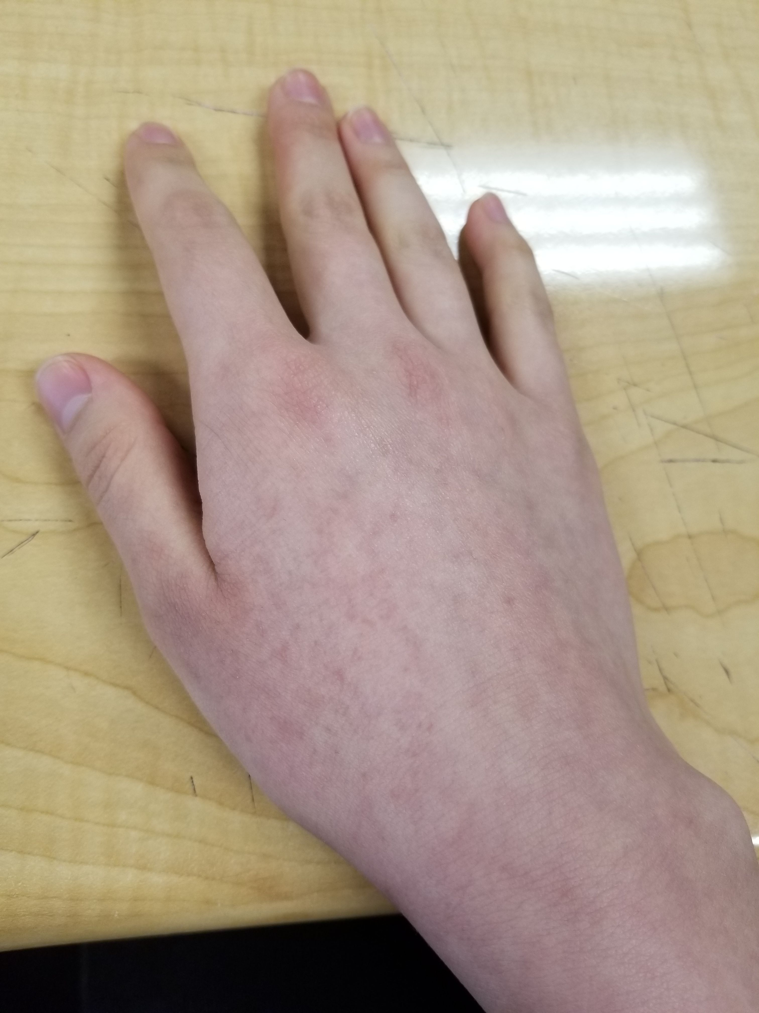 Bite Beauty - Allergic Reactions? - Beauty Insider Community