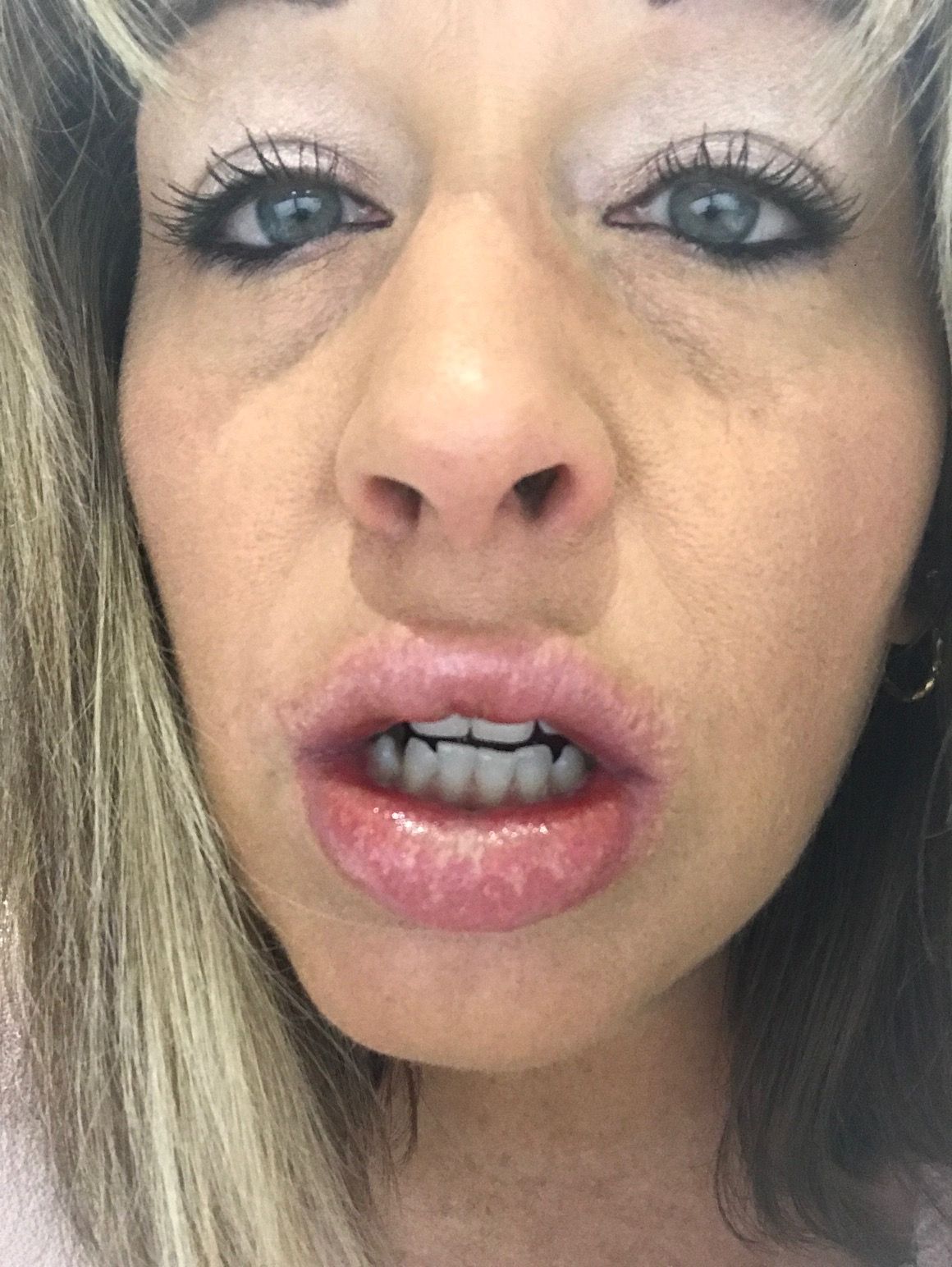 Bite Beauty - Allergic Reactions? - Beauty Insider Community