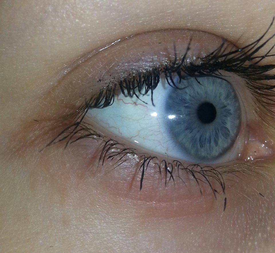 Texture underneath my eyes? - Beauty Insider Community