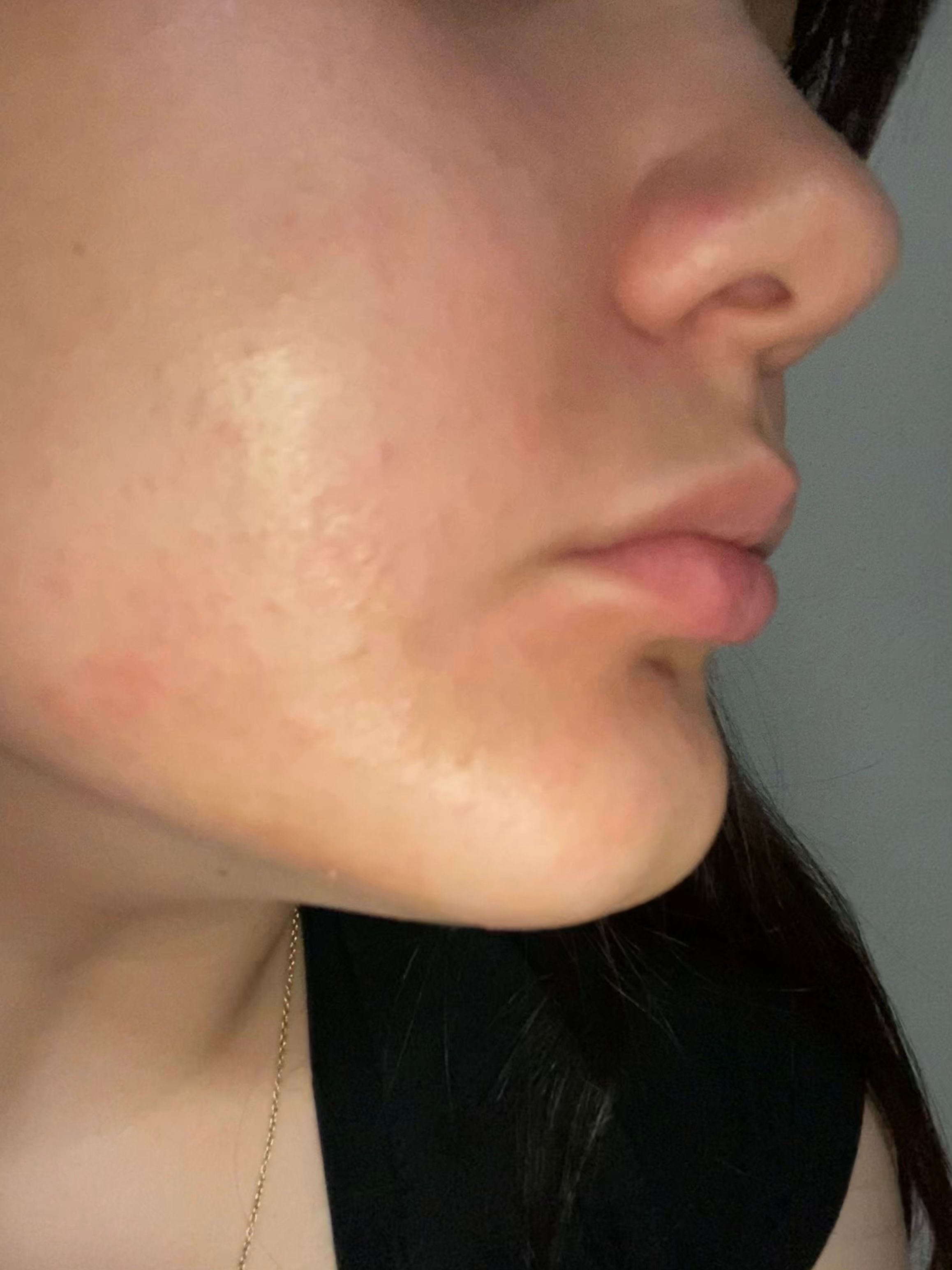 Small bumps! - Beauty Insider Community