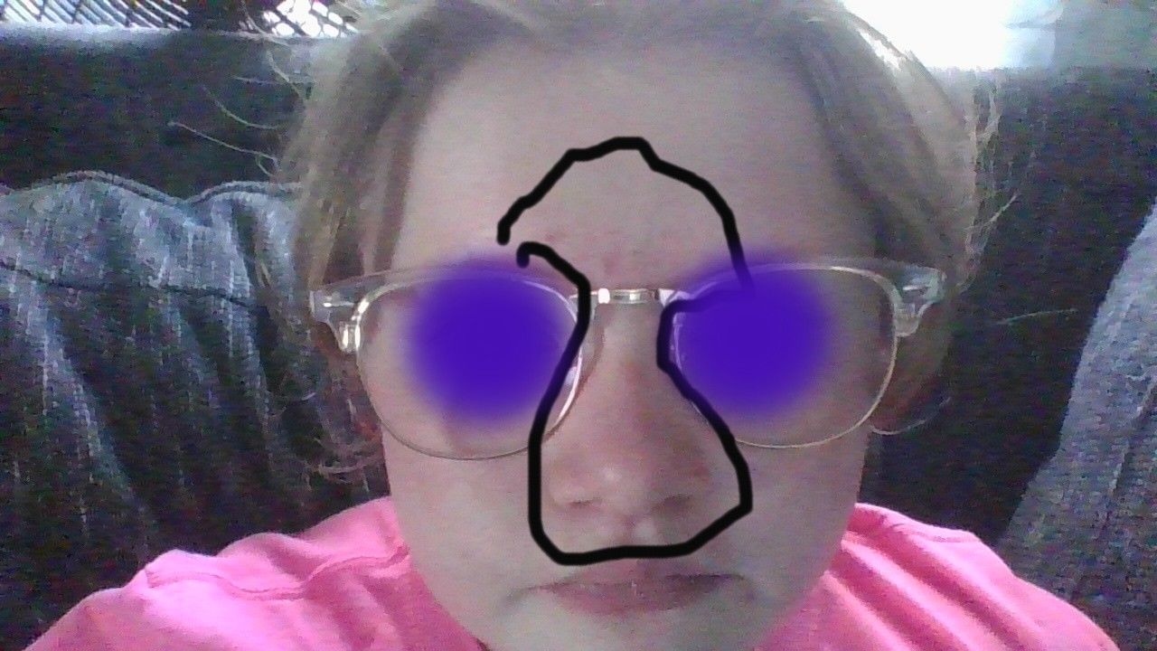 Ance In T-zone/nose PLEASE HELP!!! - Beauty Insider Community