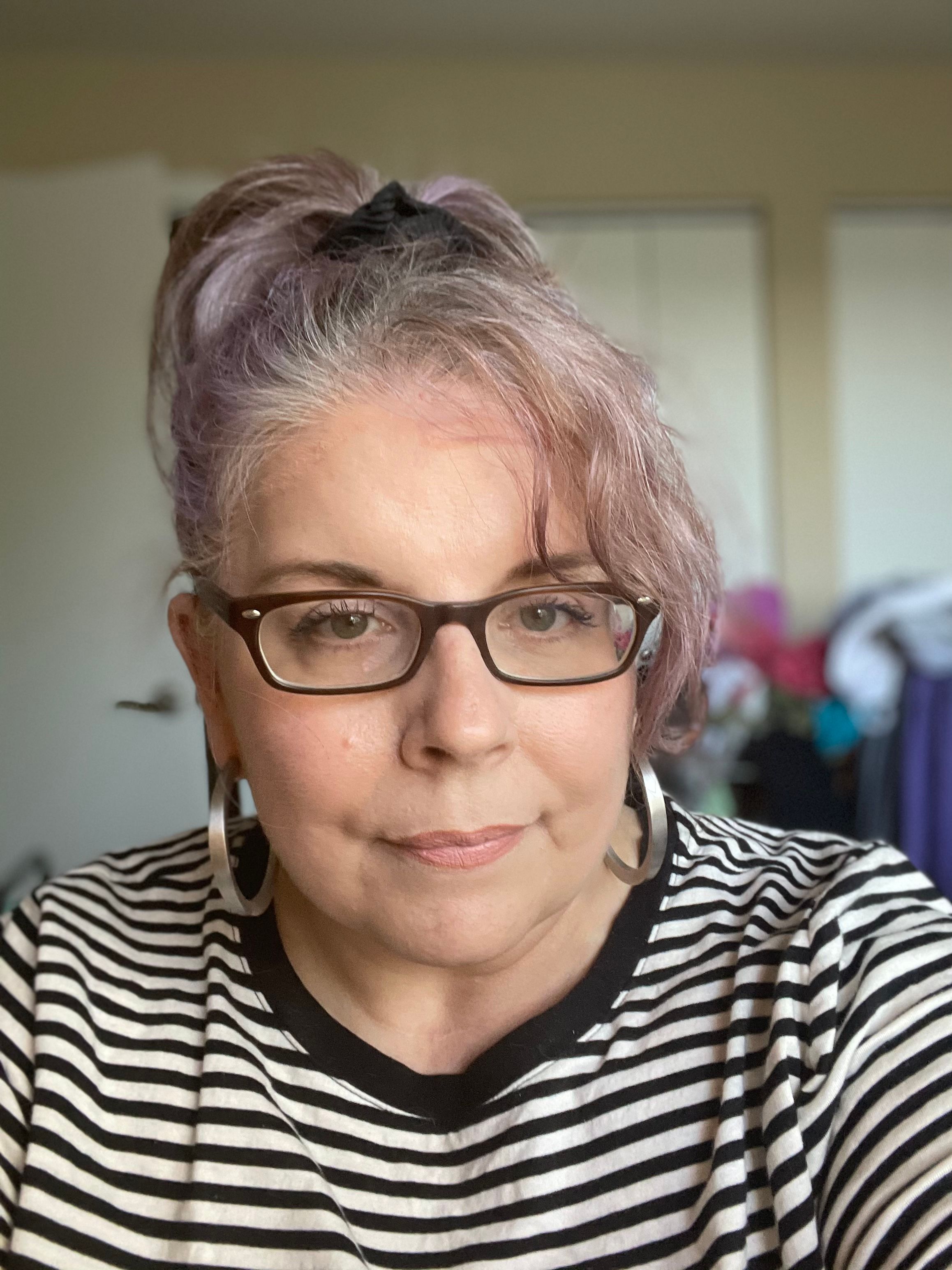 Lip lines-eek! - Beauty Insider Community