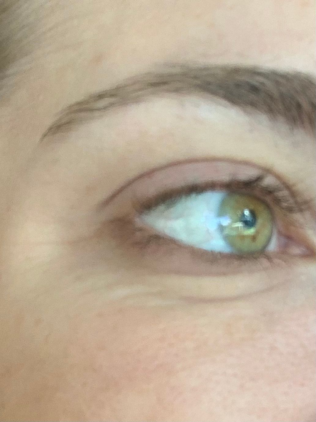 Under eye wrinkles & crows feet? - Beauty Insider Community