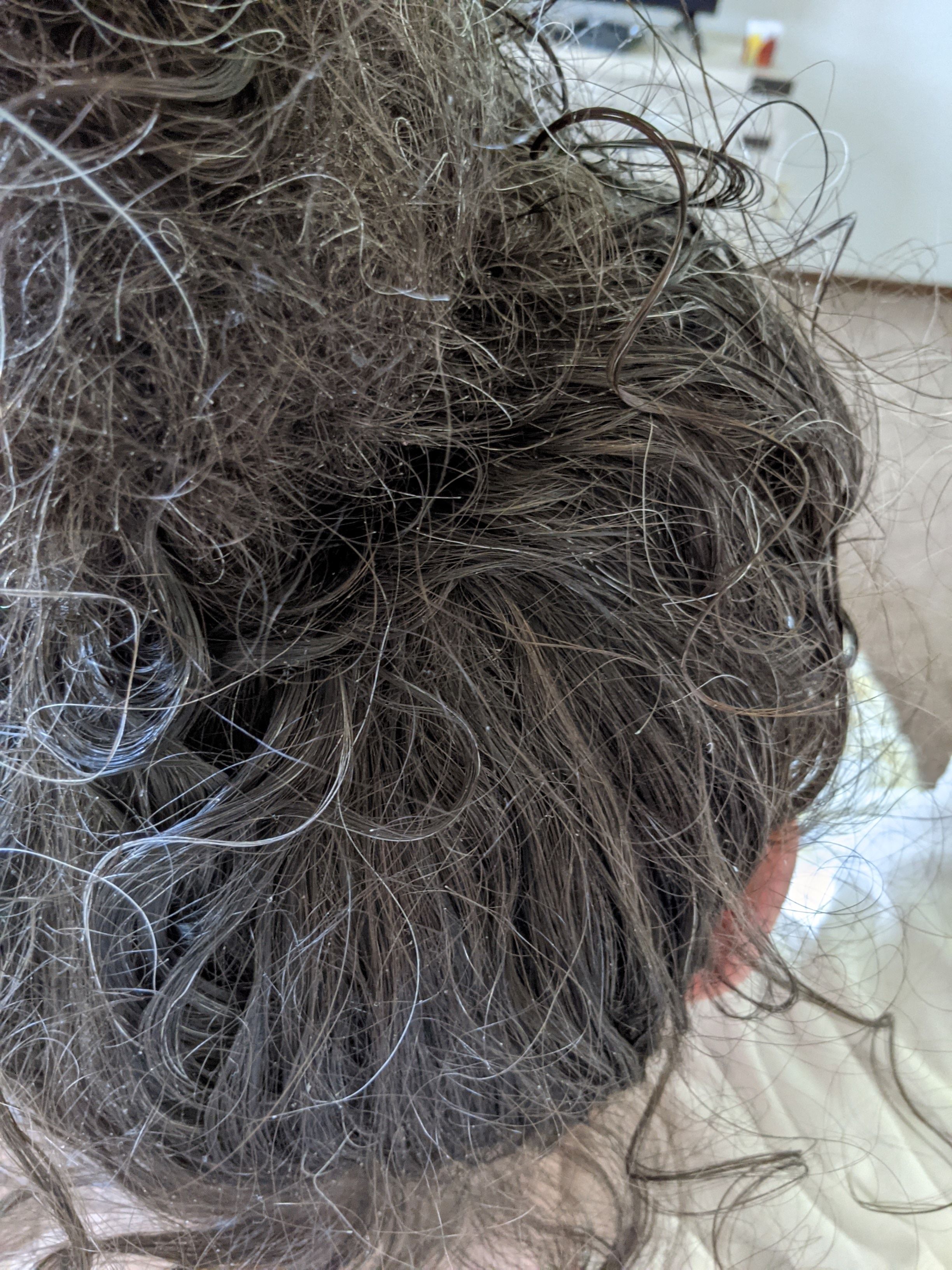Severely Matted Bun - Beauty Insider Community