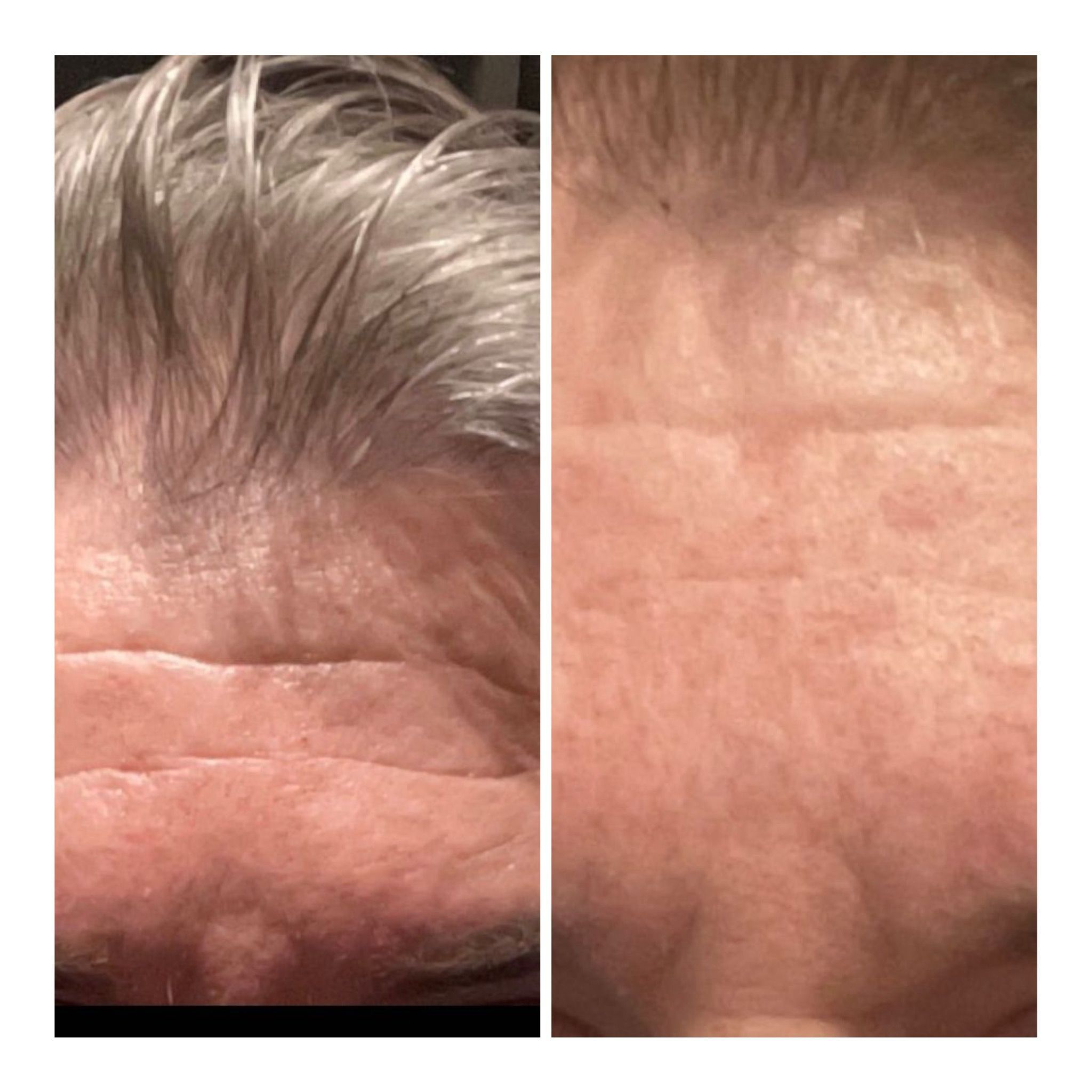 SKIN|ATP changed my skincare routine for... - Beauty Insider Community