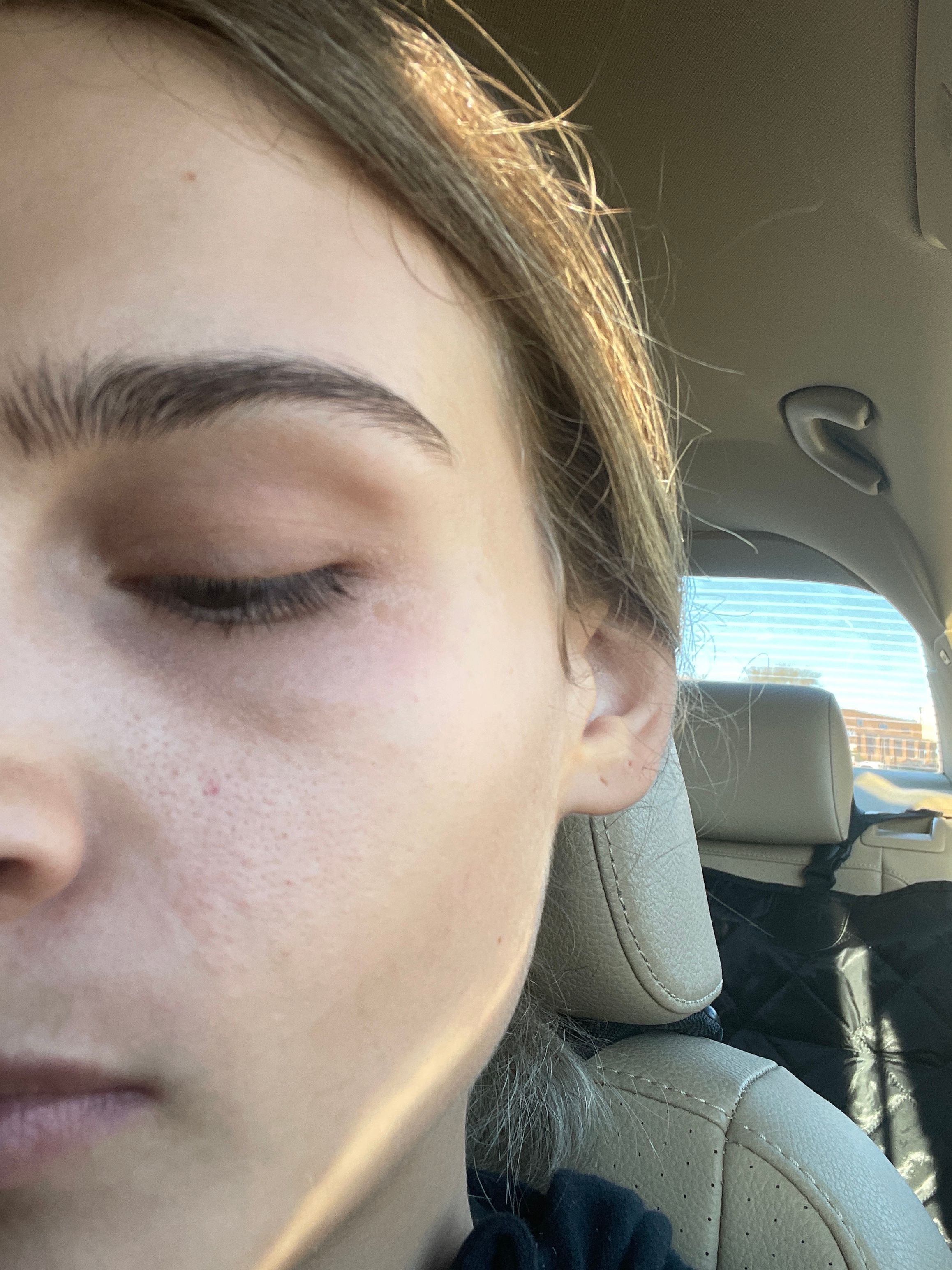 Ole Henricksen Allergic Reaction - Beauty Insider Community