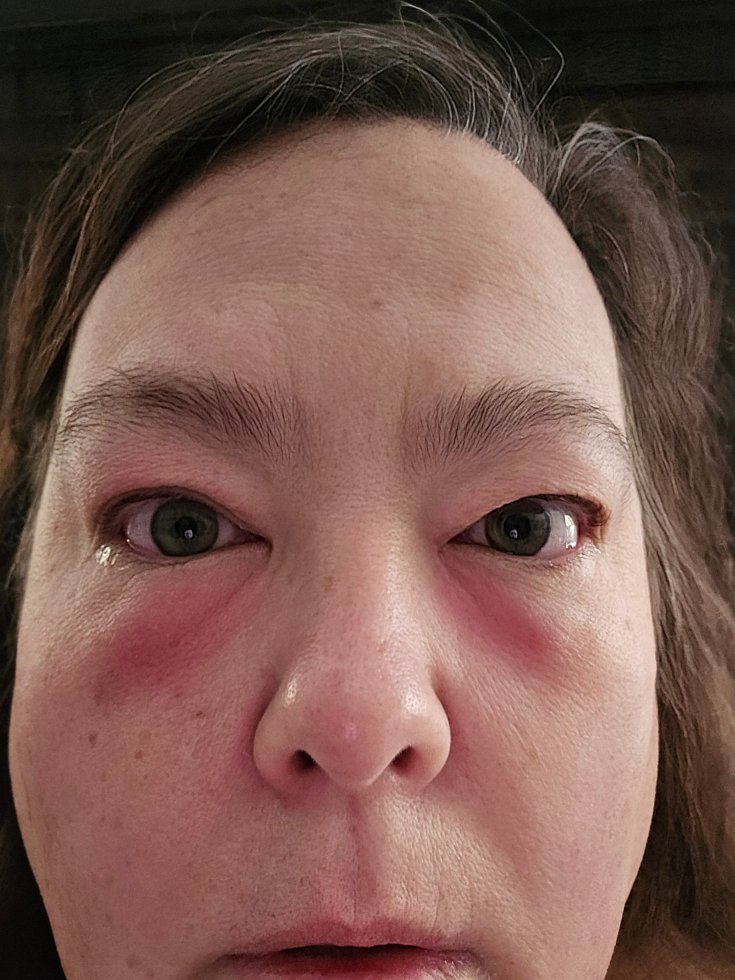 Ole Henricksen Allergic Reaction - Beauty Insider Community