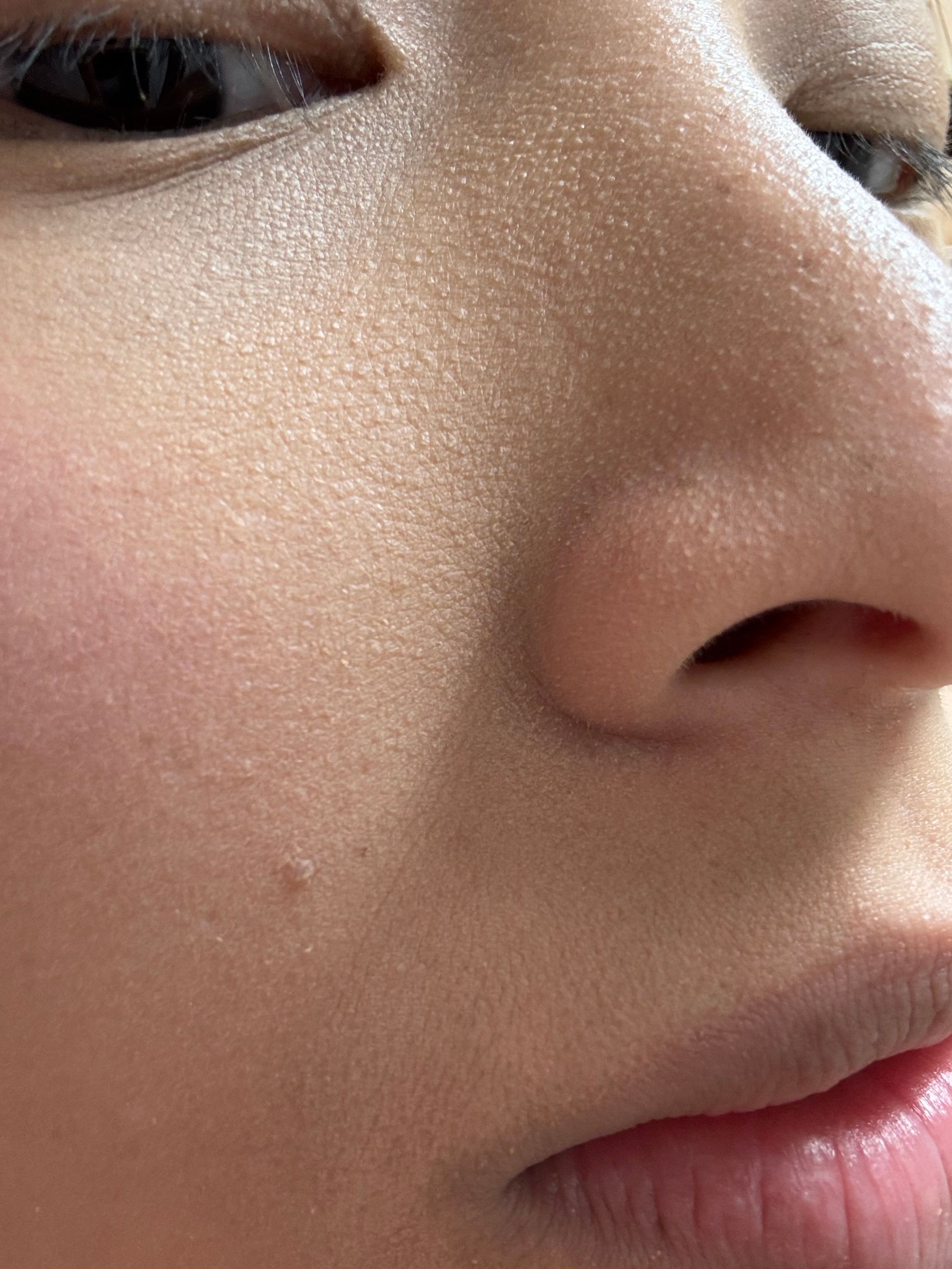 What happened to my face after applying ... - Beauty Insider Community