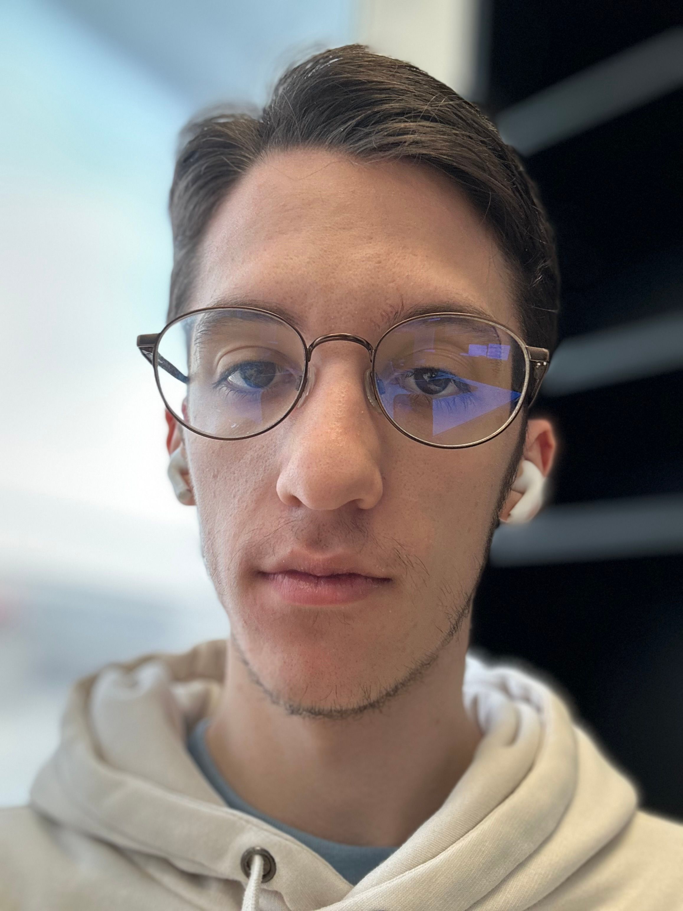 Help for skin/lip and other - Beauty Insider Community