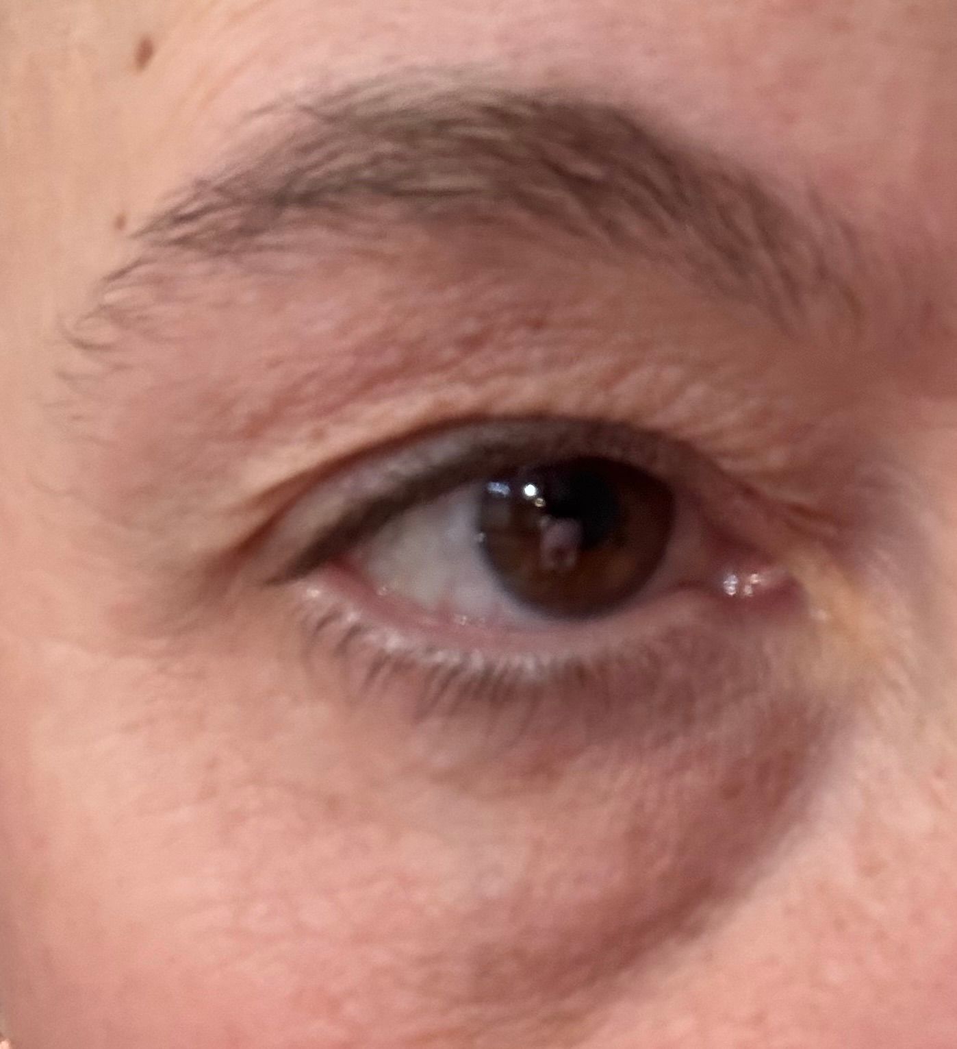 Eyelid texture! Help!! - Beauty Insider Community