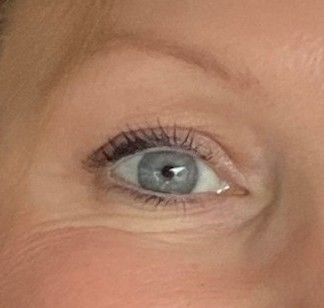 Eyelid texture! Help!! - Beauty Insider Community