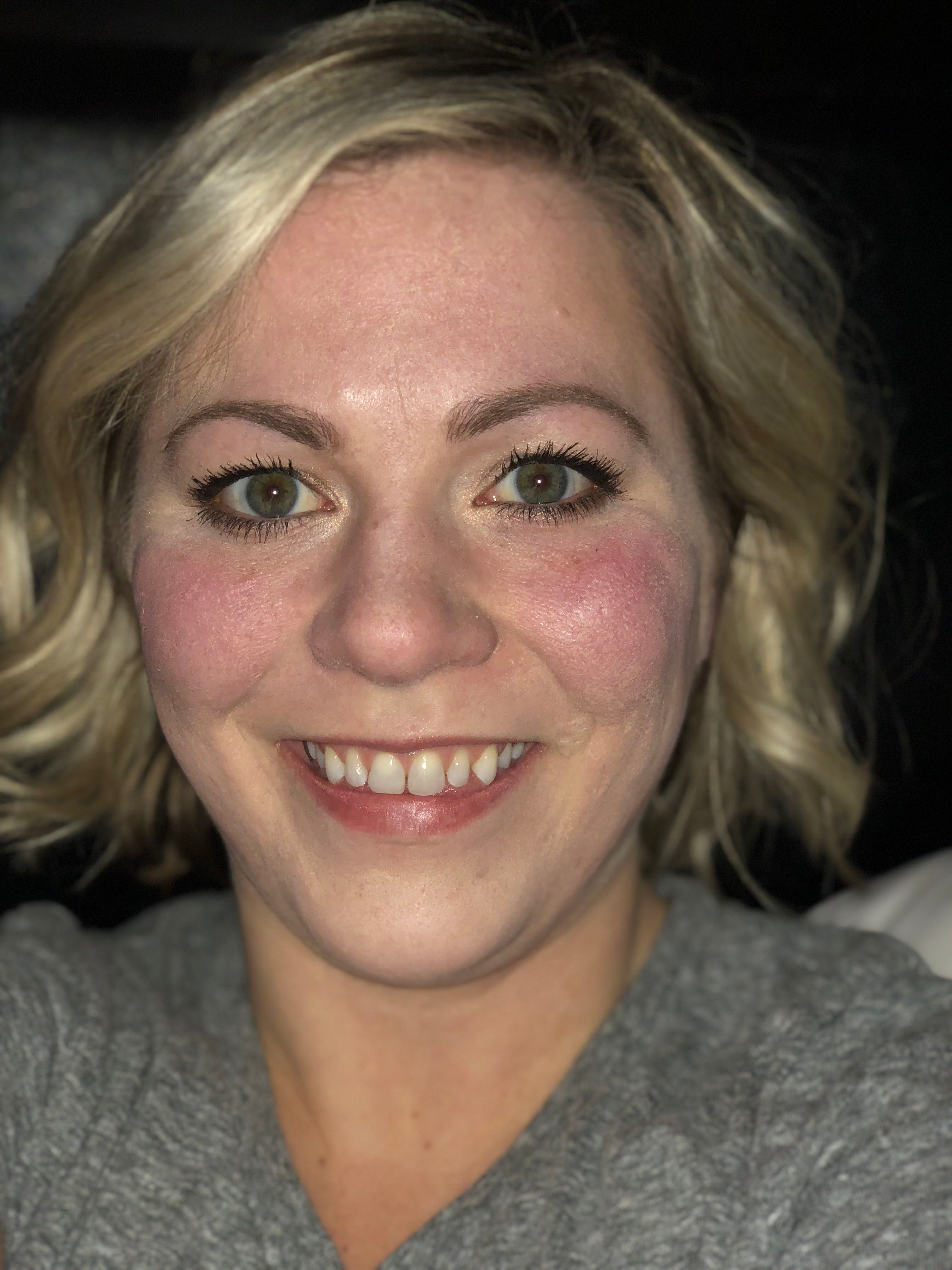 I need help with everything face related... - Beauty Insider Community